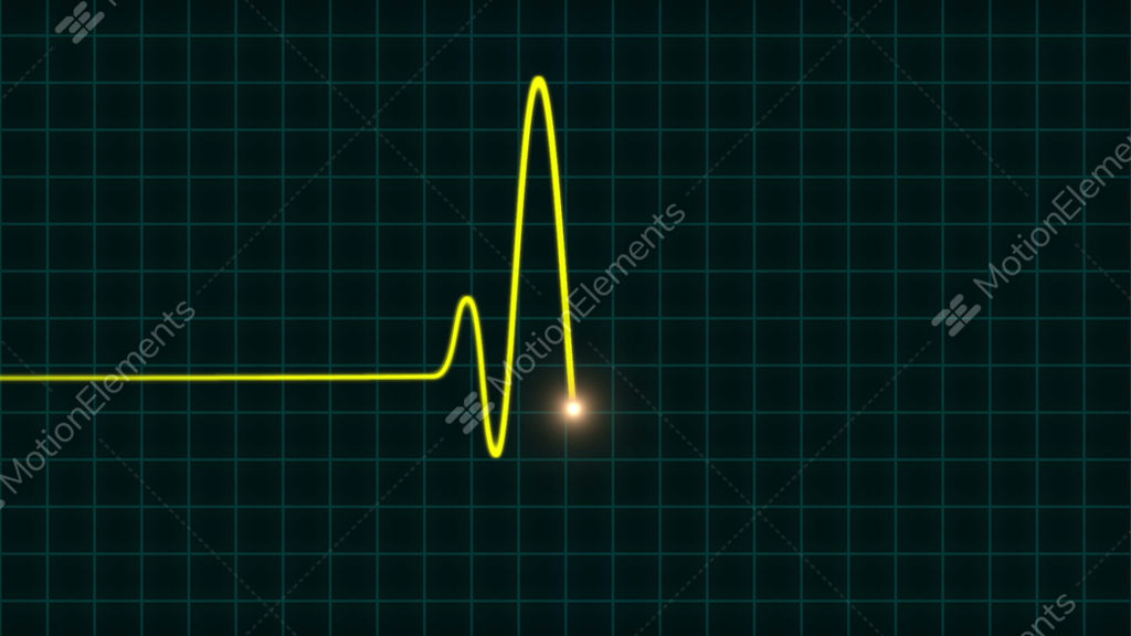 Imagehgkl Heartbeat Monitor Line